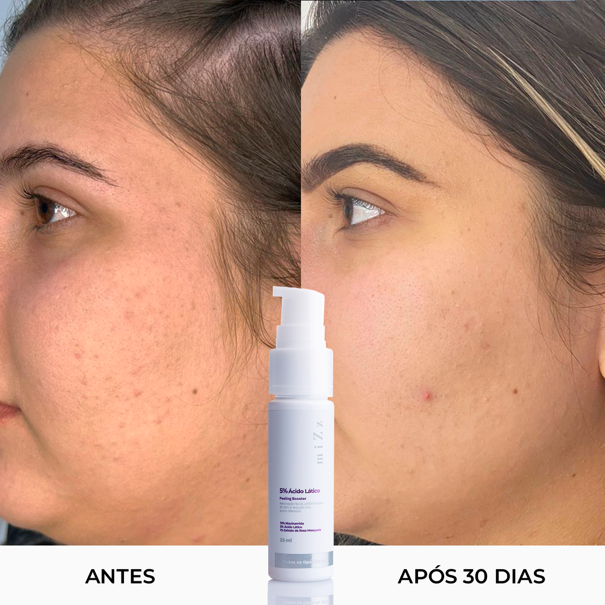 Mizz | Performance em cada gota - miZz Dermocosméticos