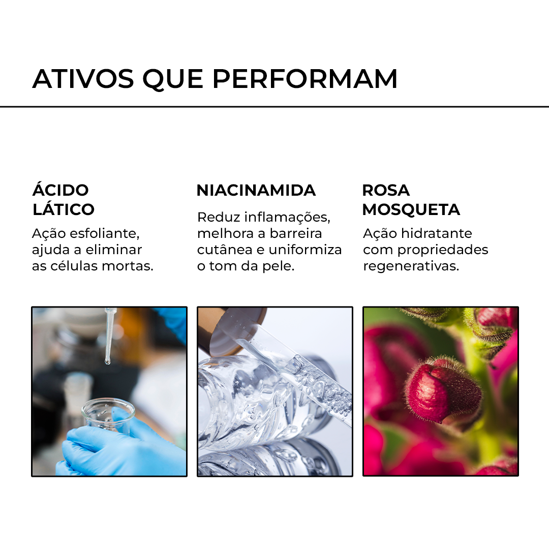 Kit 3 Ácidos Mais Vendidos Mizz